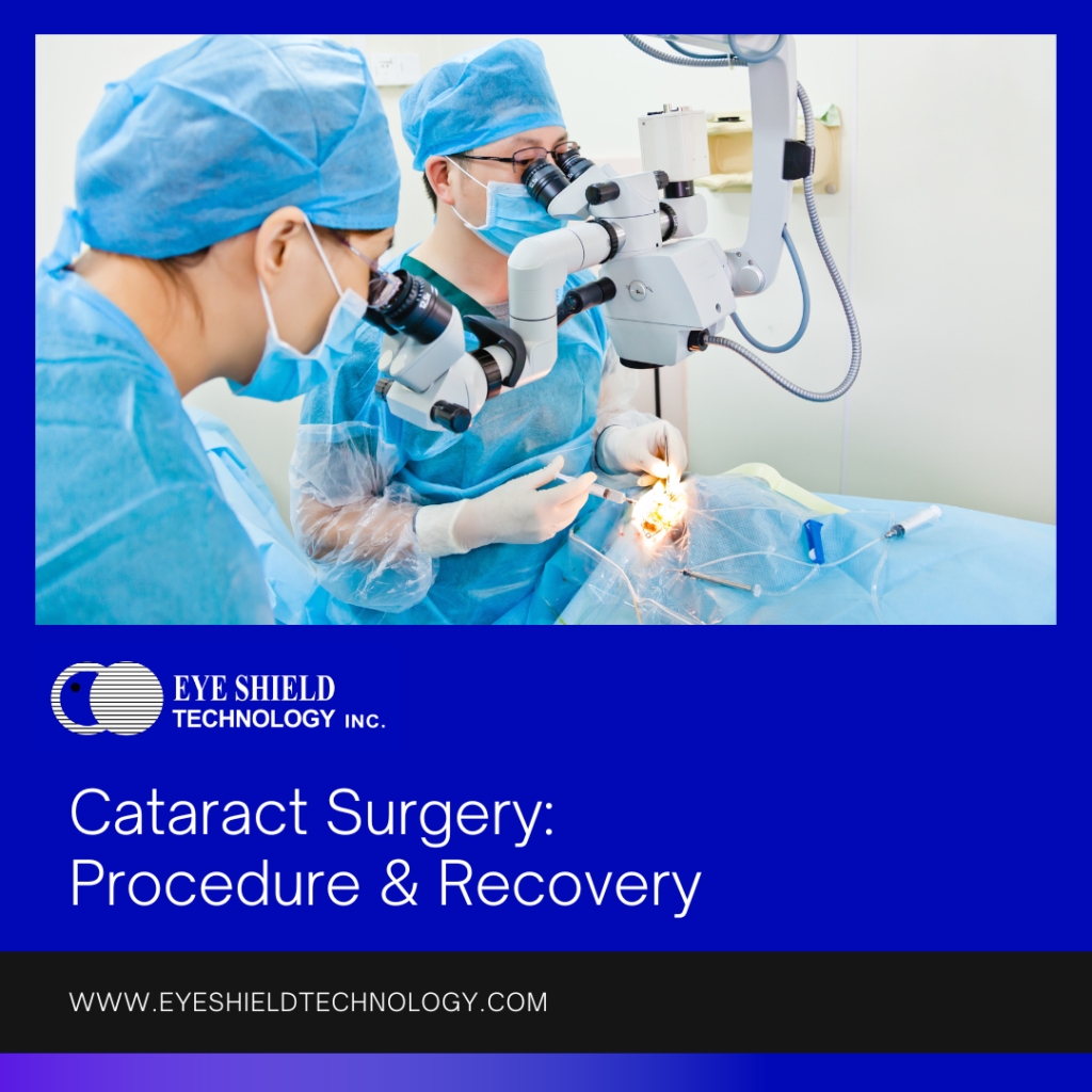 Cataract Surgery: Procedure & Recovery - Eye Shield Technology