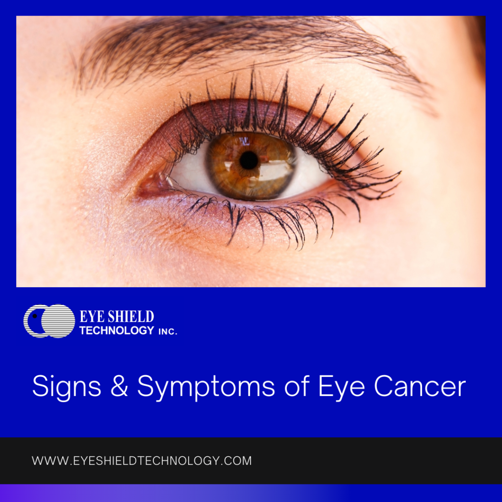 Signs & Symptoms of Eye Cancer - Eye Shield Technology